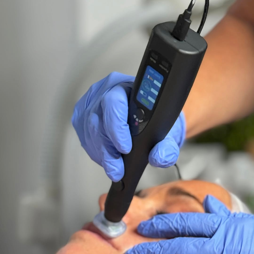 CoolJet Device - Plasma Pen